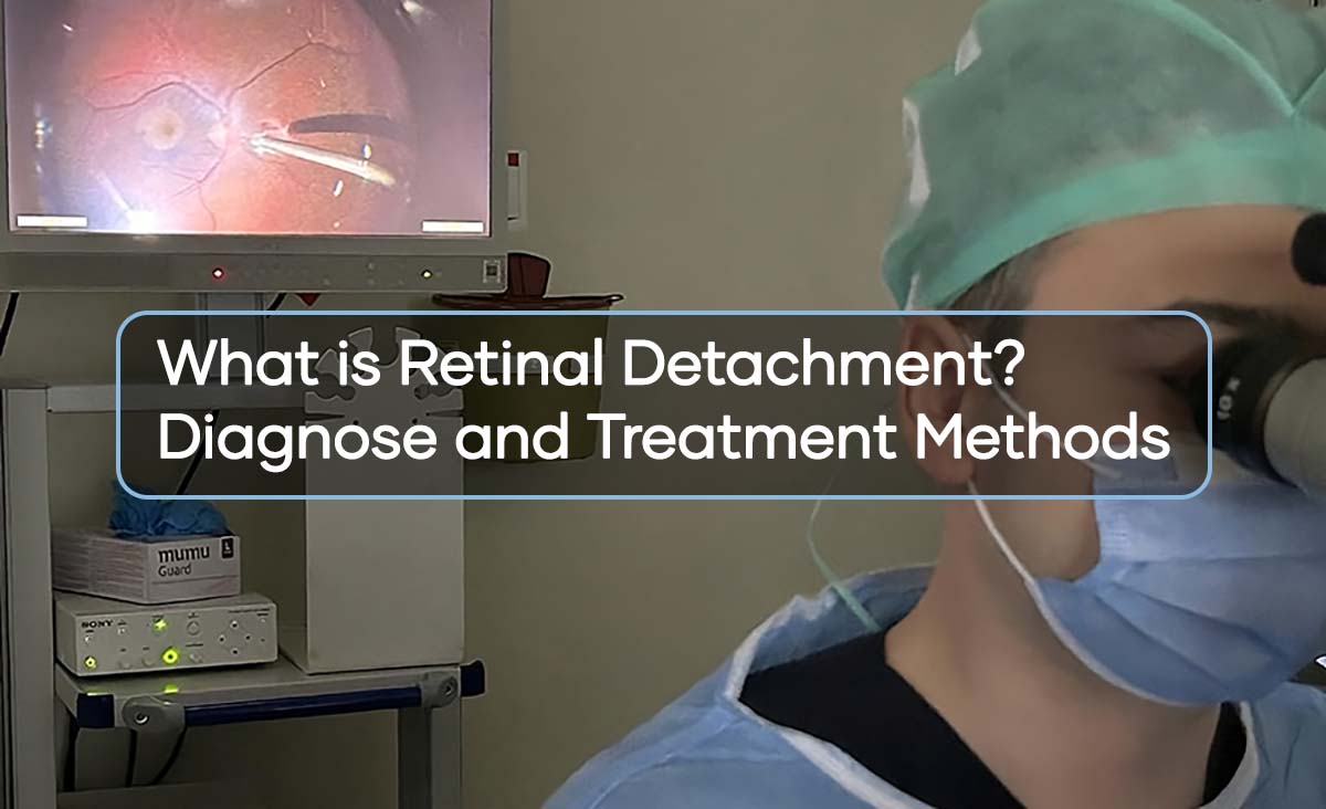 What is Retinal Detachment? How is Retinal Detachment Treated?