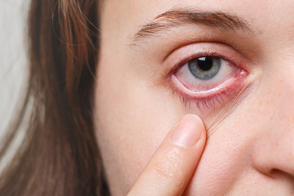 Deciphering Uveitis: An Overview of Inflammatory Eye Disease